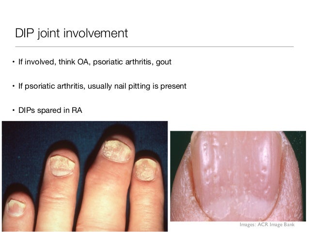 Rheumatology pearls 9-19-2014