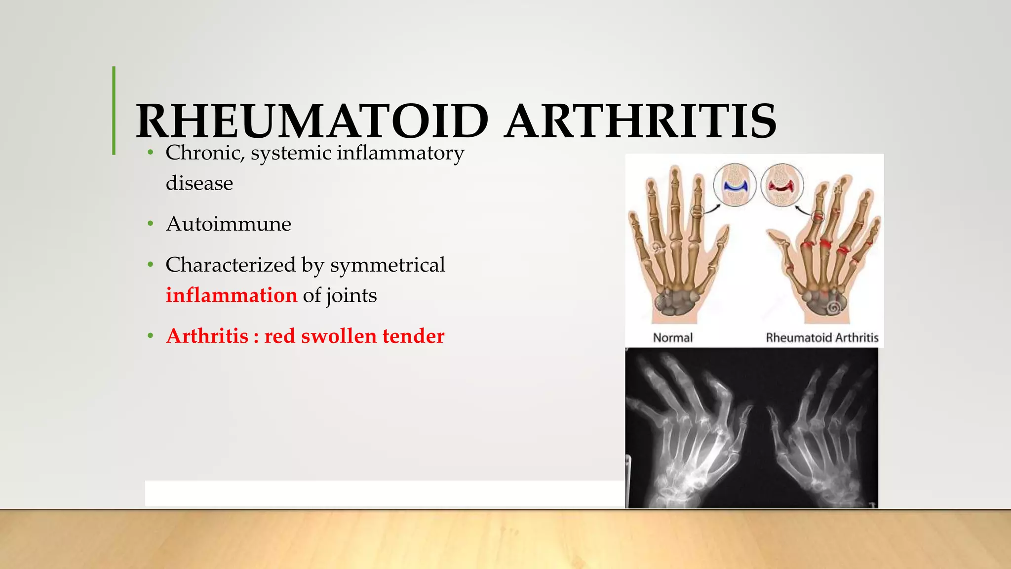 rheumatology revision [Autosaved].pptx