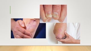 rheumatology revision [Autosaved].pptx