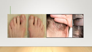 rheumatology revision [Autosaved].pptx