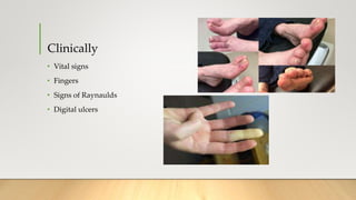 rheumatology revision [Autosaved].pptx