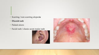 rheumatology revision [Autosaved].pptx