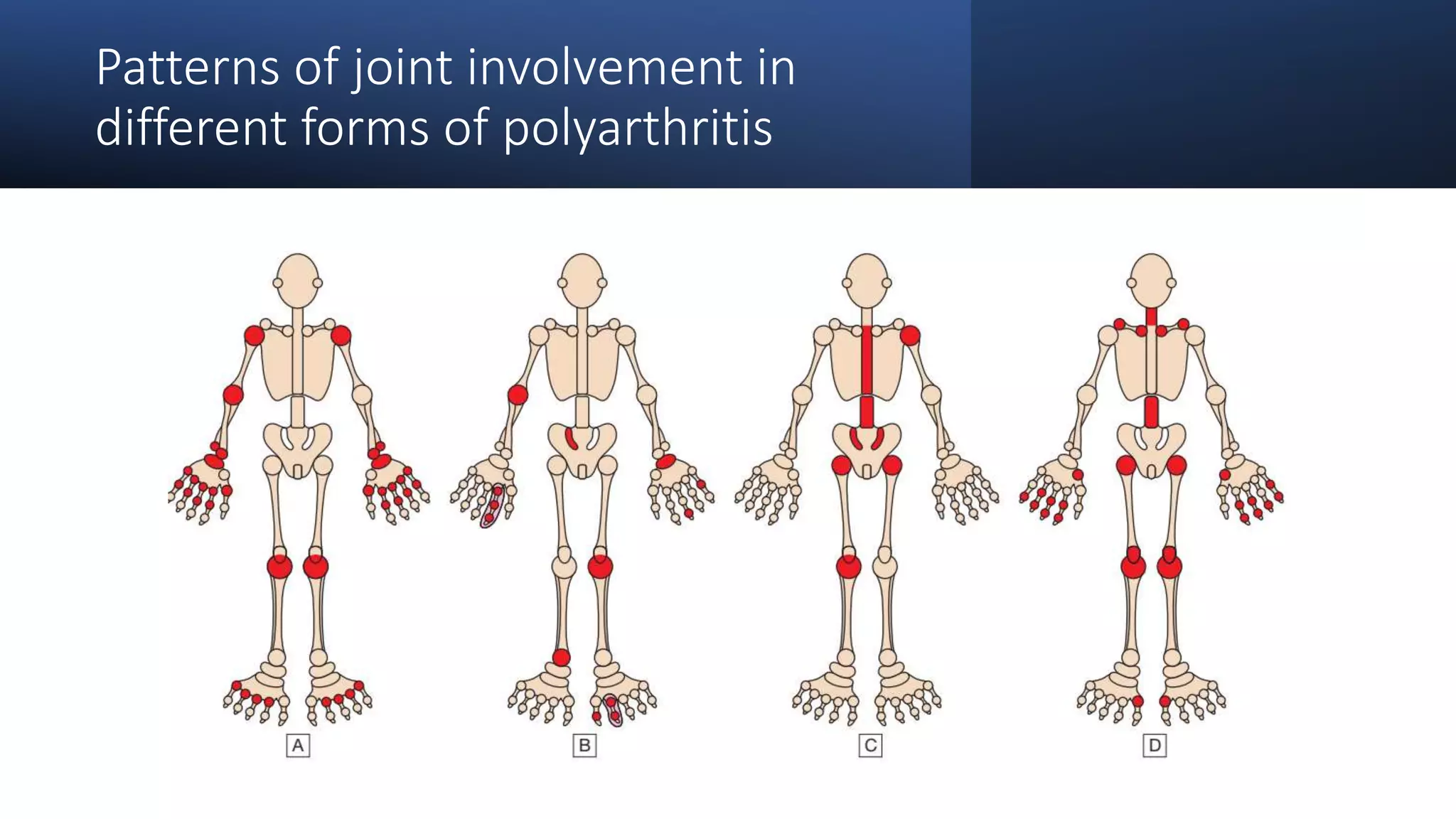 Rheumatology Clinical Examination for Undergrad | PPTX