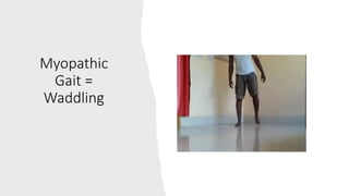 Rheumatology Clinical Examination for Undergrad | PPTX