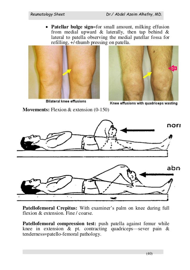 Rheumatology sheet