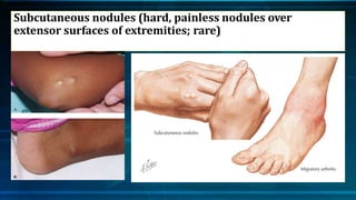 Subcutaneous Nodules Rheumatic Fever