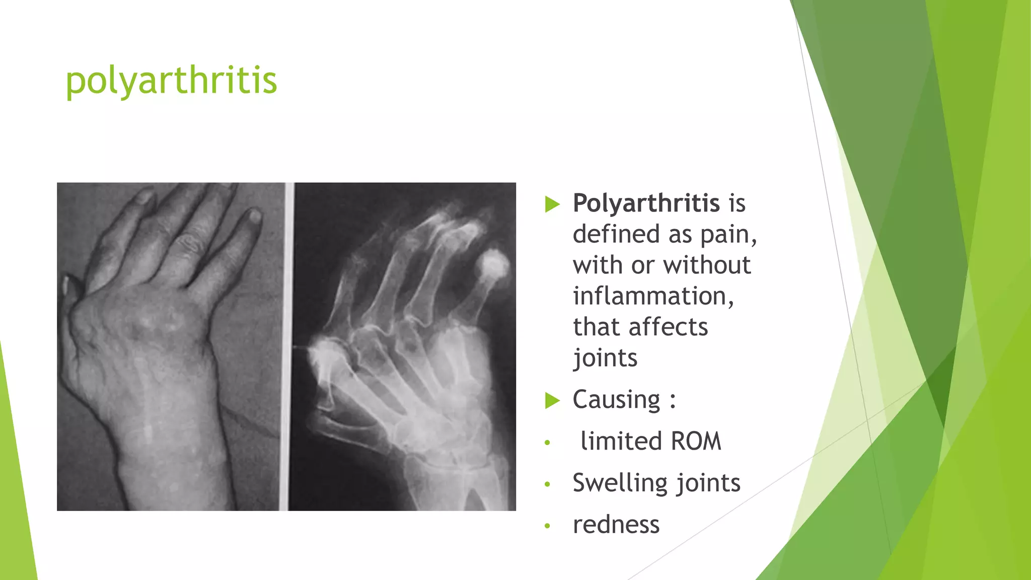 Rheumatic heart disease (nursing ppt ) | PPTX
