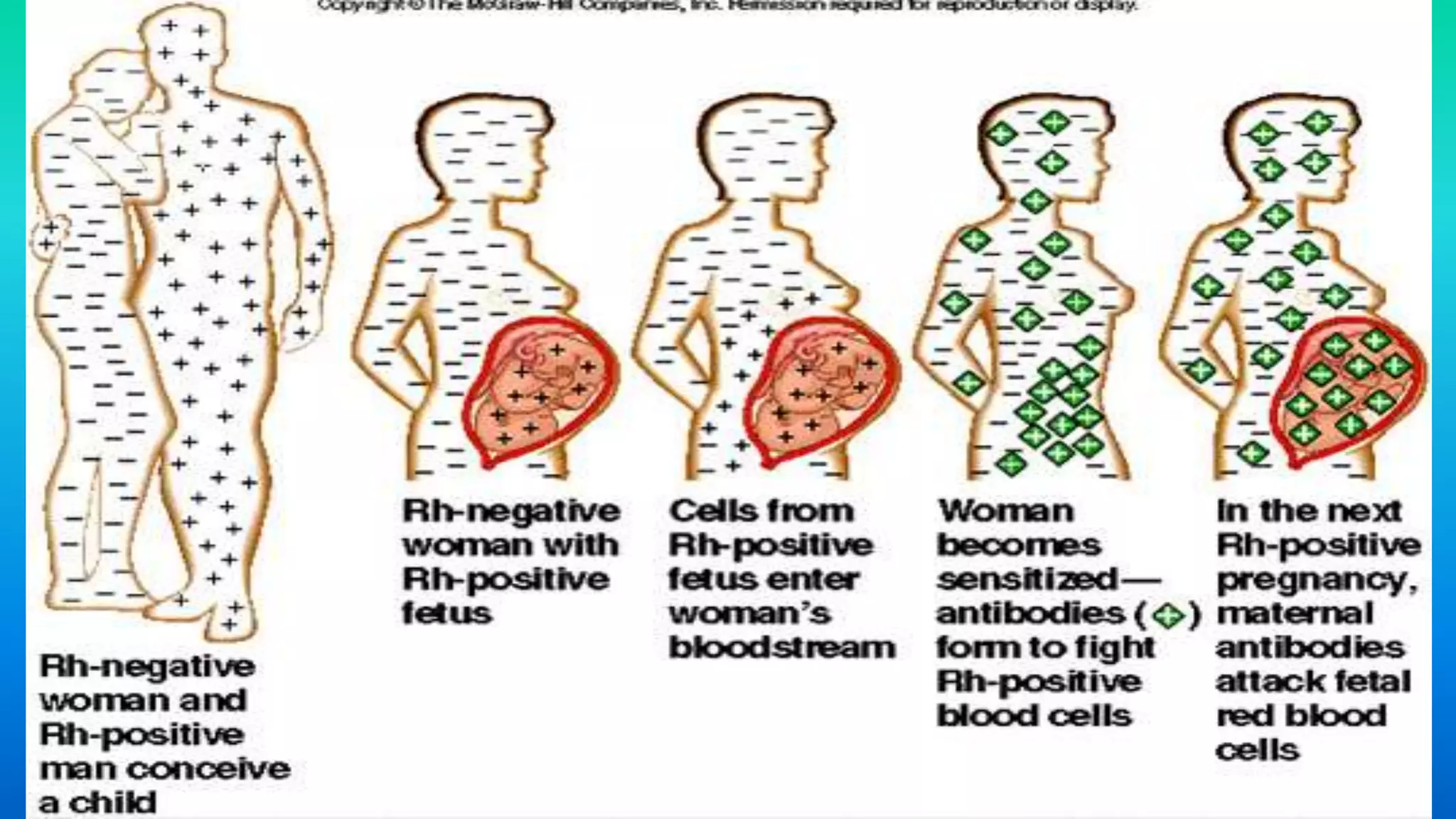 Rh incompatibility | PPTX