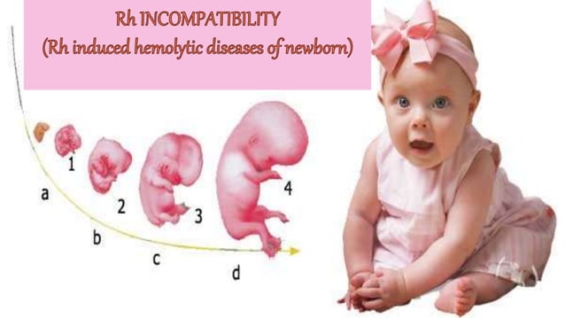 Rh incompatibility | PPTX | Pregnancy | Reproductive Health