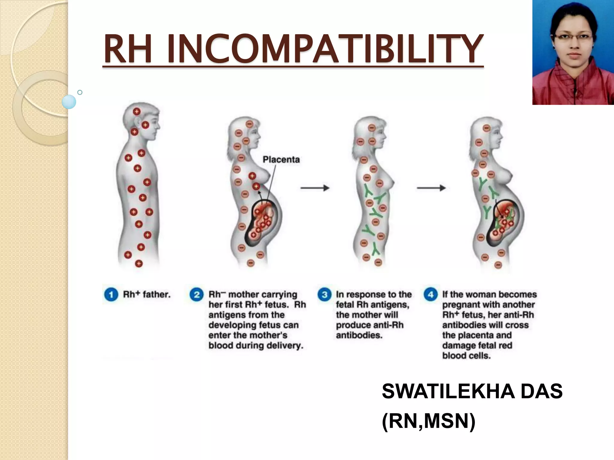 Rh Incompatibility I Hemolytic Disease of the Newborn | PDF