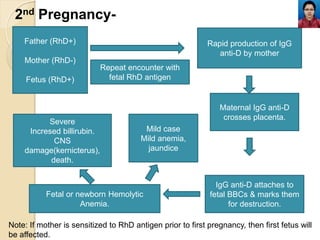 Rh Incompatibility I Hemolytic Disease of the Newborn | PDF