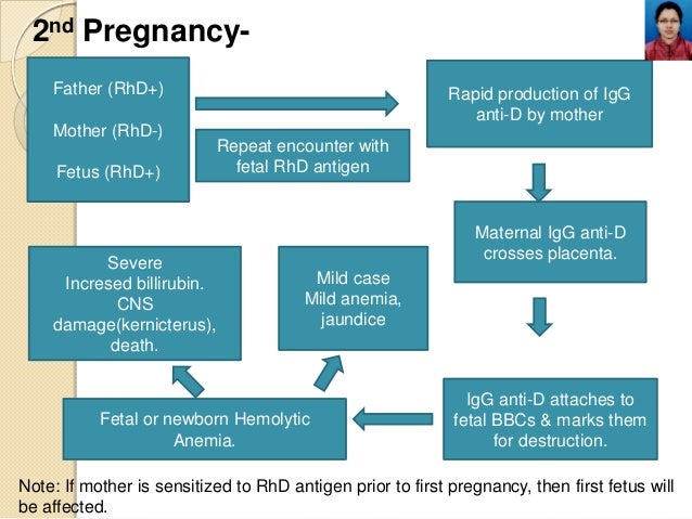 Rh Incompatibility I Hemolytic Disease of the Newborn
