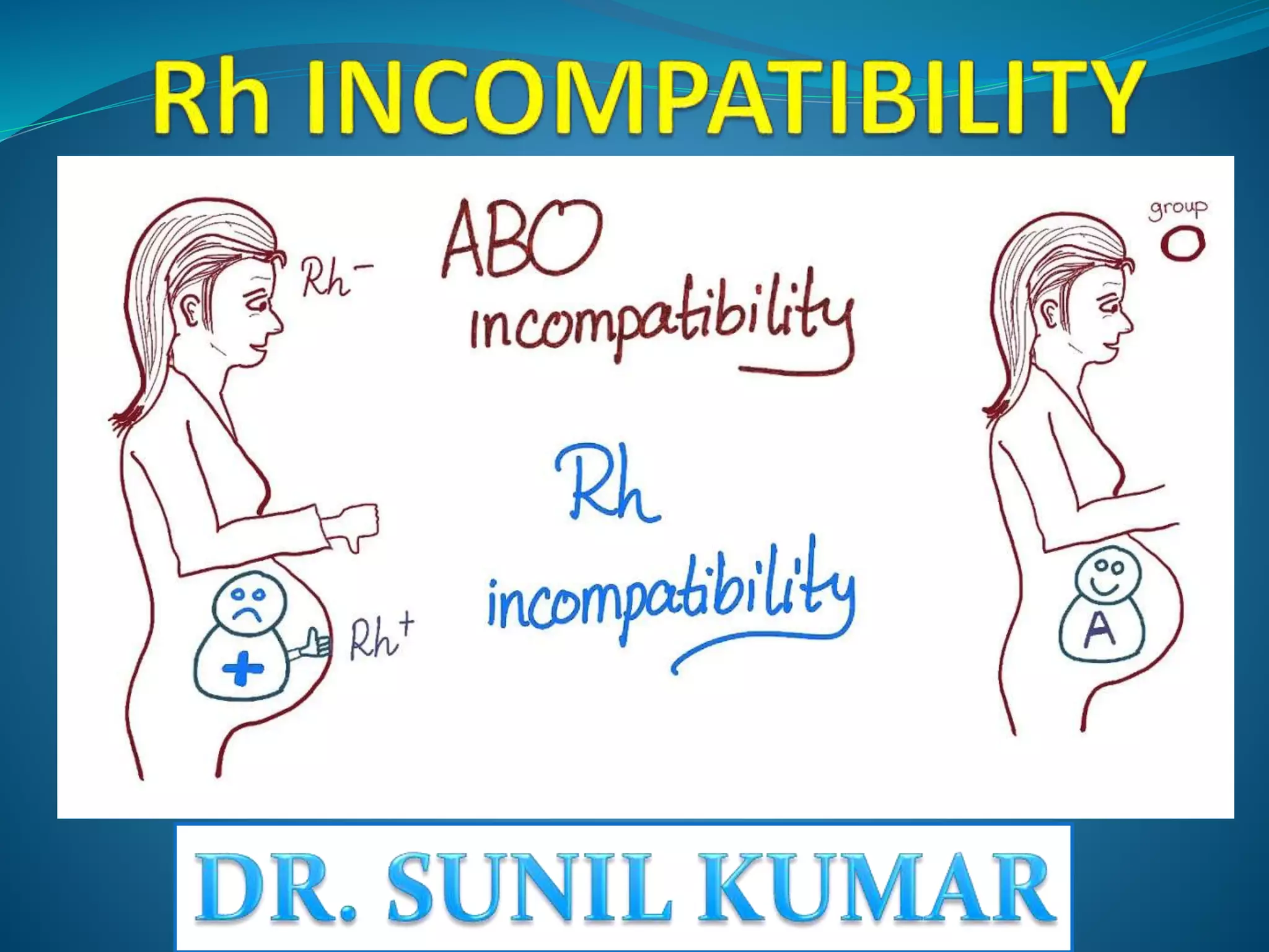 Rh incompatibility | PPTX