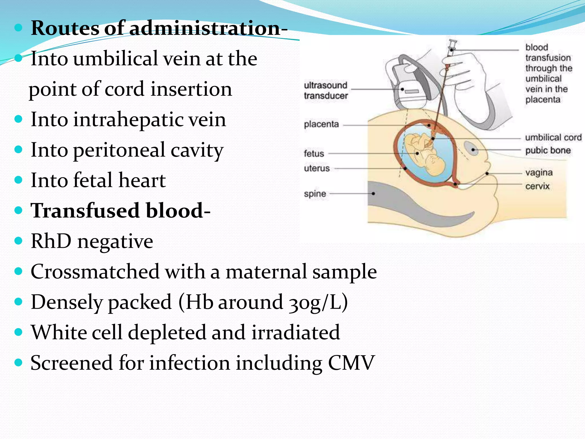 Rh incompatibility | PPT