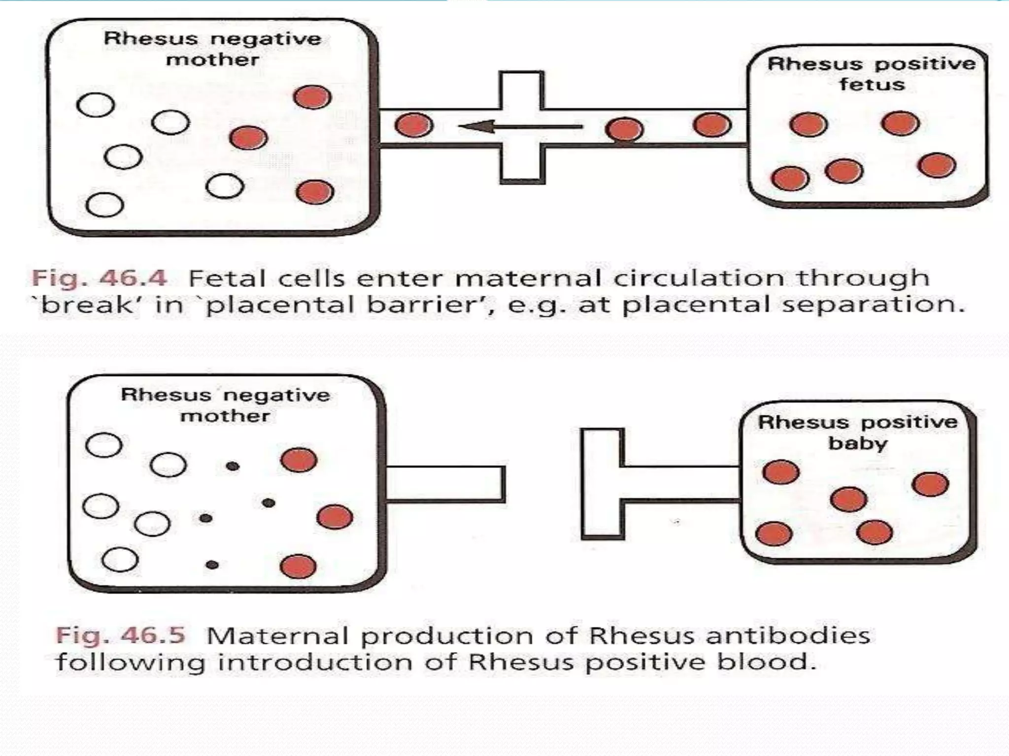 Rh incompatibility | PPTX