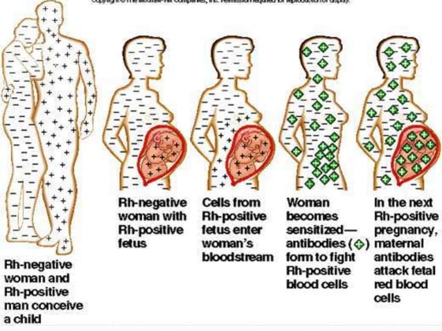 Rh incompatibility | PPTX | Pregnancy | Reproductive Health