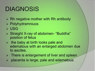 Rh incompatibility | PPTX