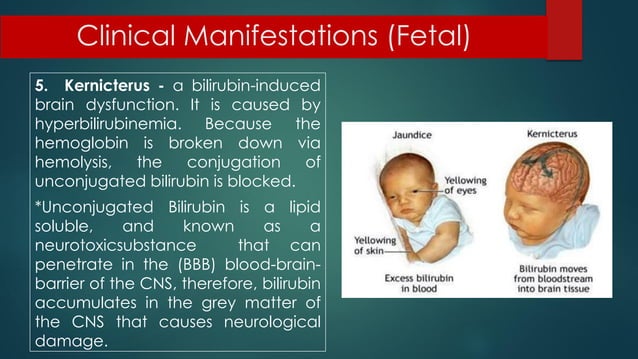 Rh incompatibility/Isoimmunization, BS Nursing | PDF