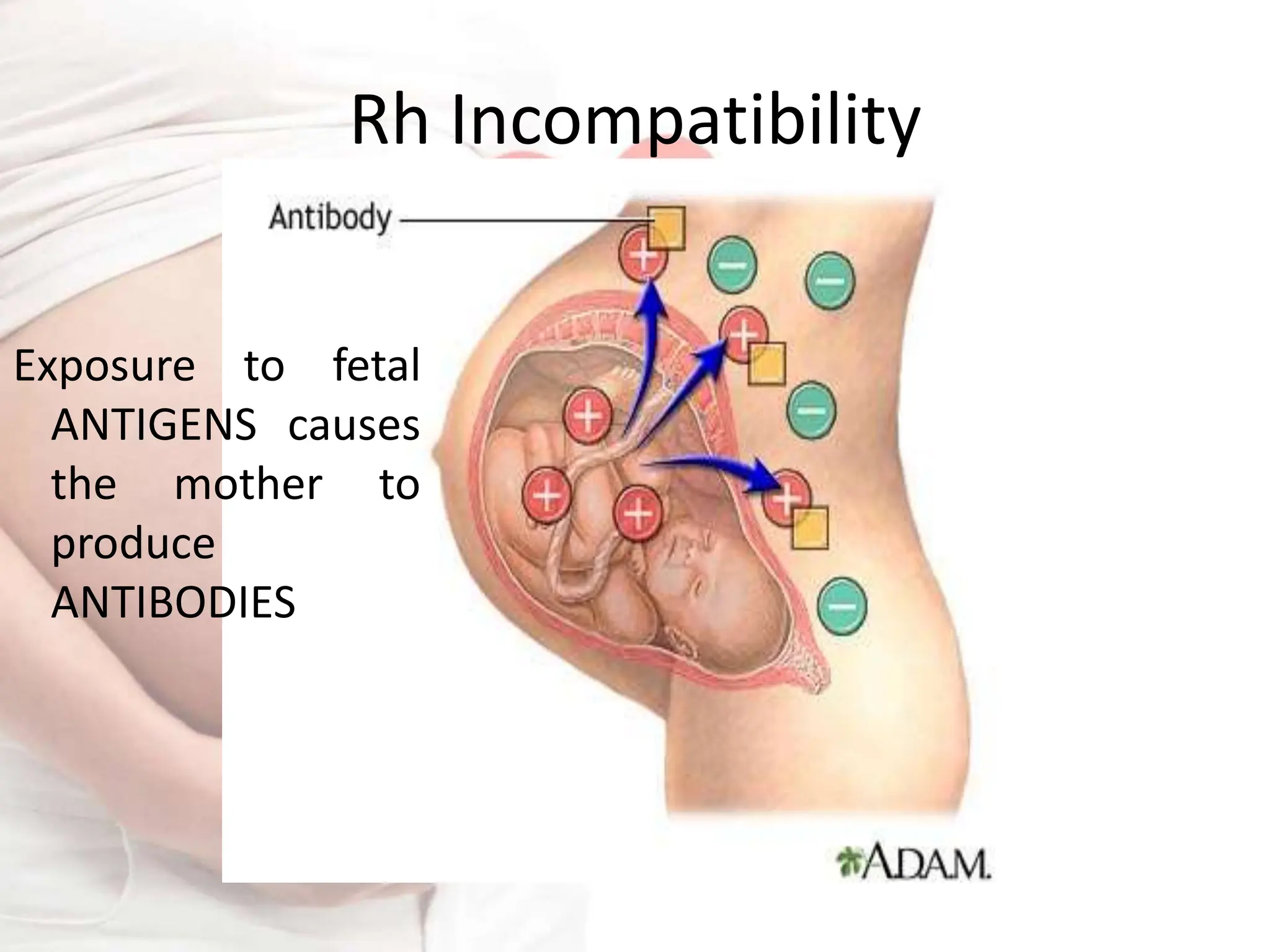Rh Incompatibility a Gynecological disorder | PPT