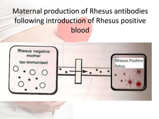 Rh Incompatibility a Gynecological disorder | PPT