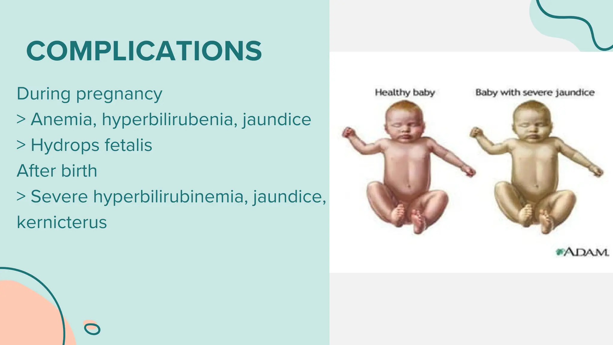 Rh incompatibility (final) .pdf SlideShare | PDF