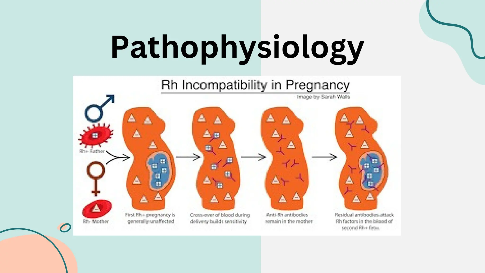 Rh incompatibility (final) .pdf SlideShare | PDF