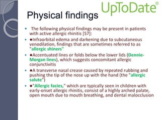 RhinoSinusitis | PPT