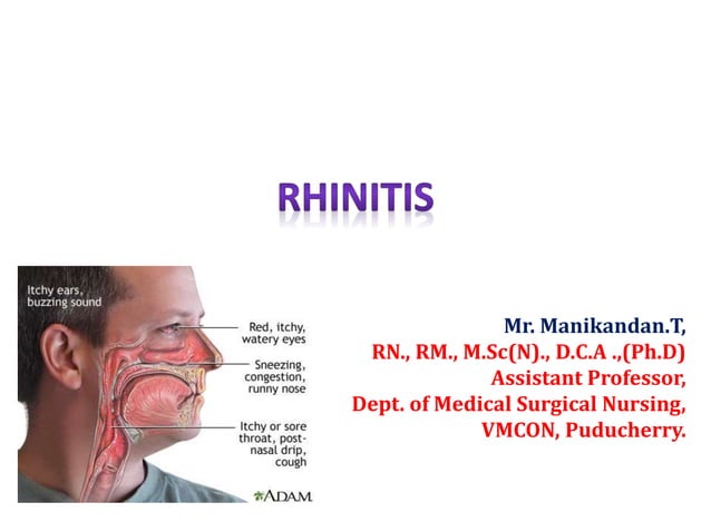 Rhinitis | PPTX