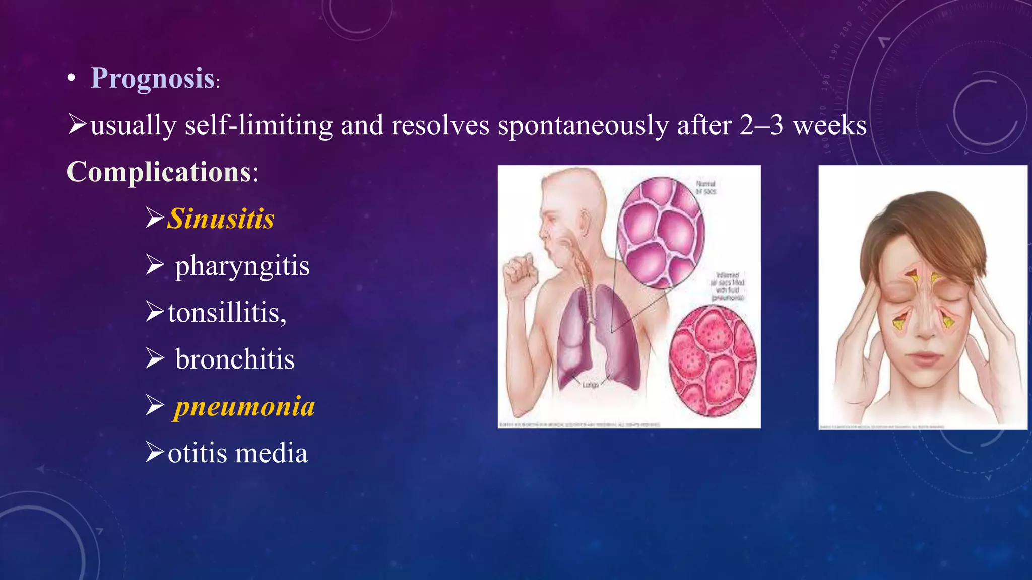 Rhinitis | PPTX