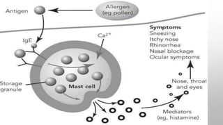 Rhinitis.pptx | Ear, Nose and Throat Conditions | Diseases and Conditions