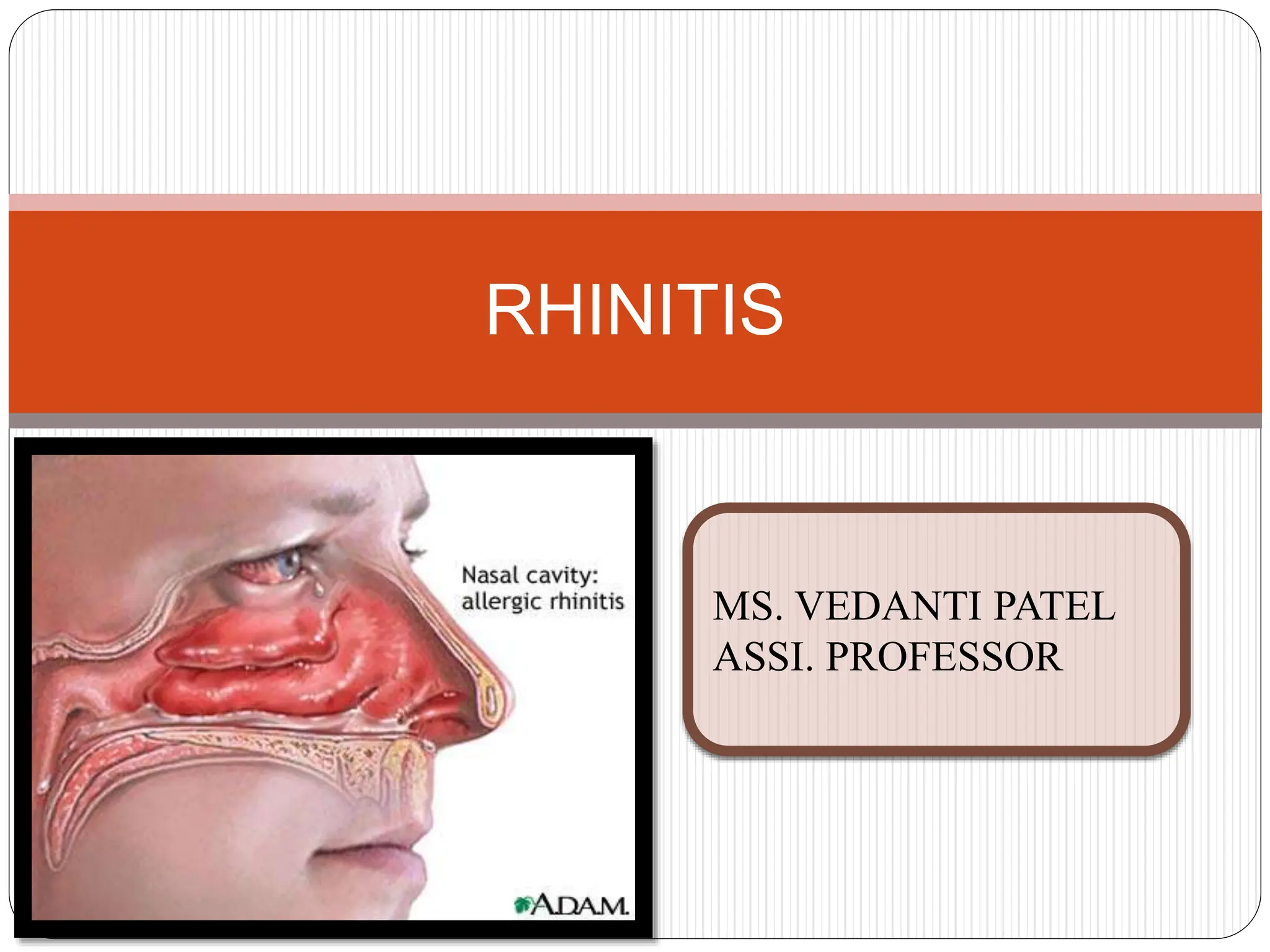 Rhinitis Slideshare Gastrointestinal Disorder | PPTX
