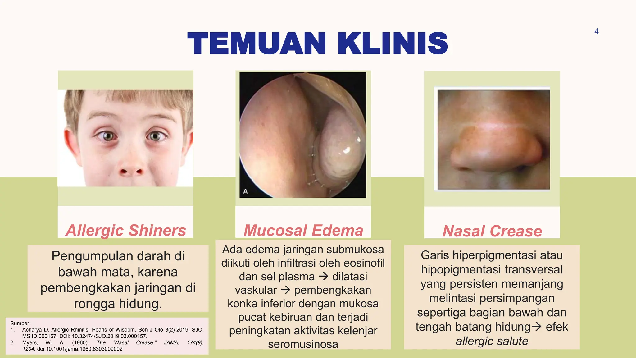 rhinitis alergi rhinitis alergi rhinitis alergi | PPTX