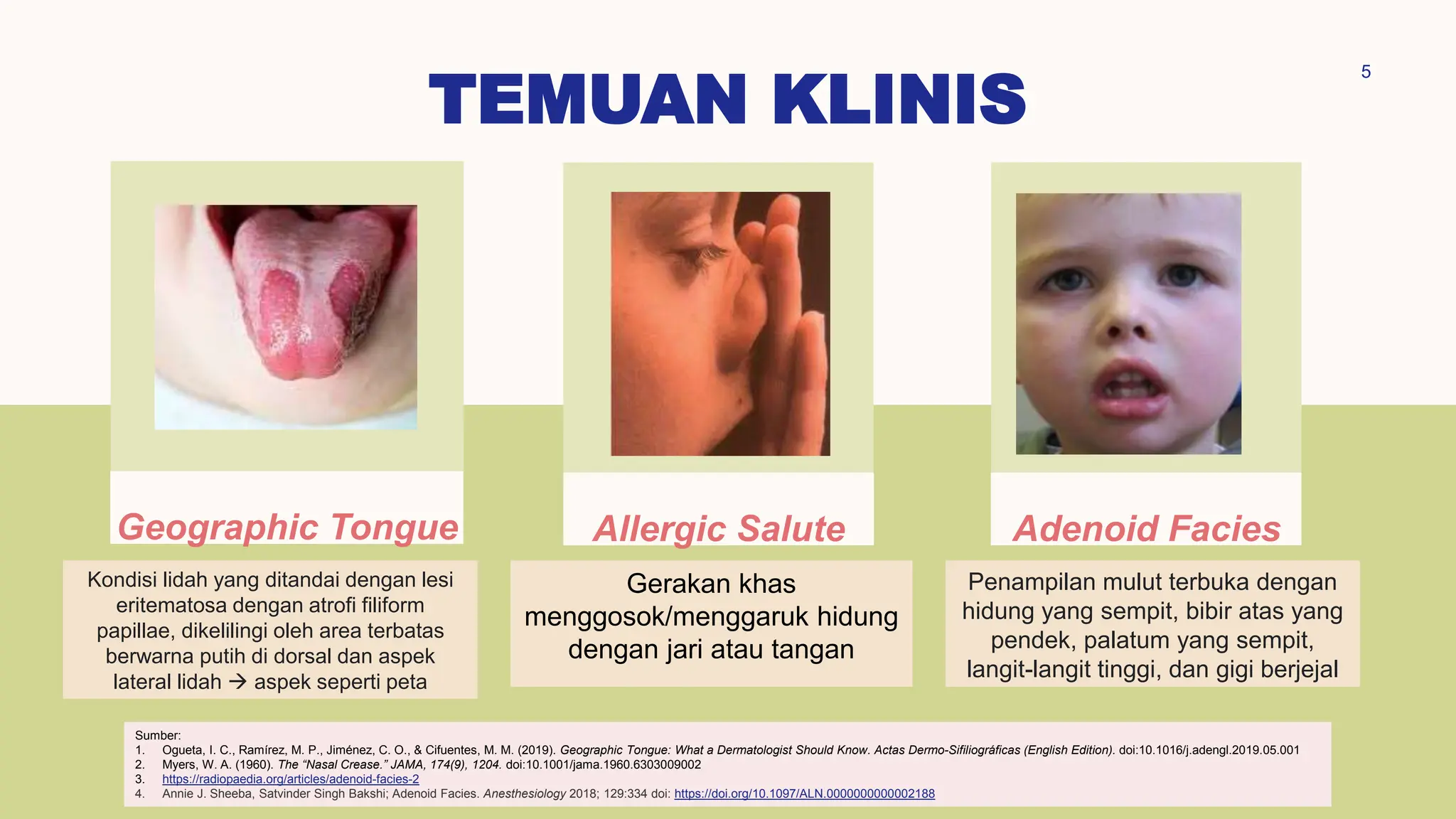 rhinitis alergi rhinitis alergi rhinitis alergi | PPTX