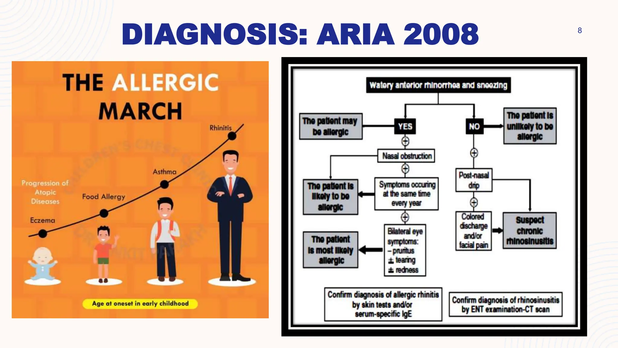 rhinitis alergi rhinitis alergi rhinitis alergi | PPTX