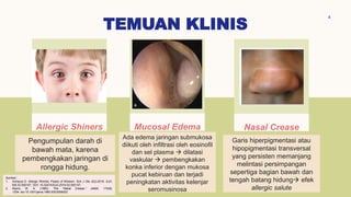 rhinitis alergi rhinitis alergi rhinitis alergi | PPTX