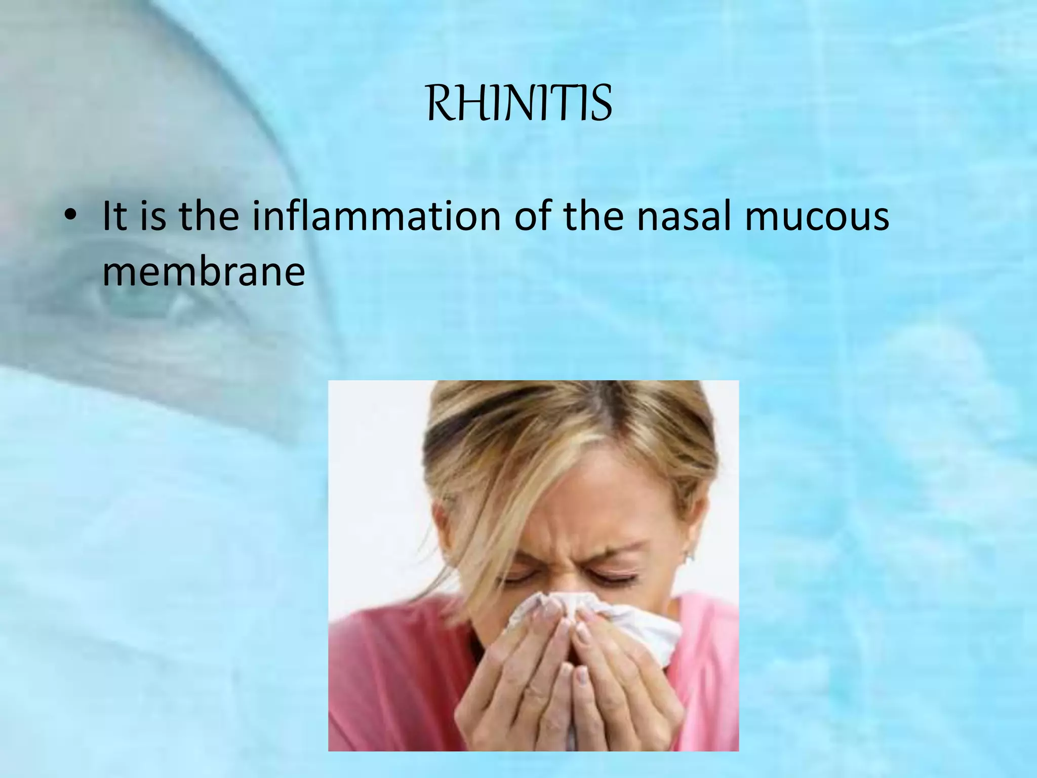 Rhinitis | PPTX | Ear, Nose and Throat Conditions | Diseases and Conditions