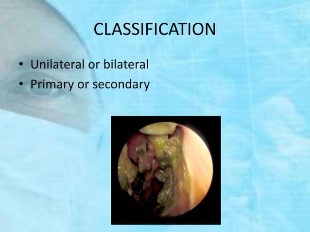 Rhinitis | PPTX | Ear, Nose and Throat Conditions | Diseases and Conditions