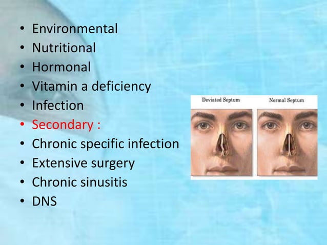 Rhinitis | PPTX | Ear, Nose and Throat Conditions | Diseases and Conditions