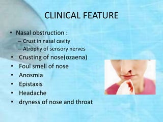 Rhinitis | PPTX