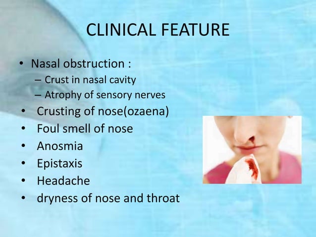 Rhinitis | PPTX | Ear, Nose and Throat Conditions | Diseases and Conditions