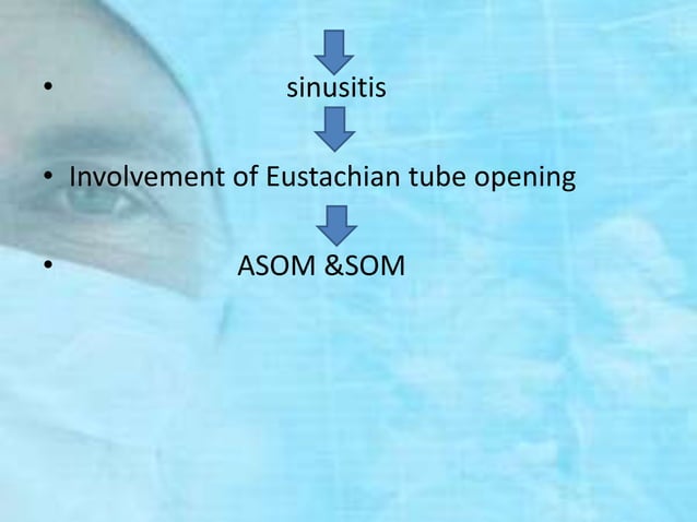 Rhinitis | PPTX | Ear, Nose and Throat Conditions | Diseases and Conditions