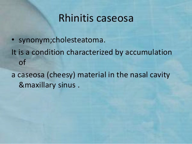 Rhinitis