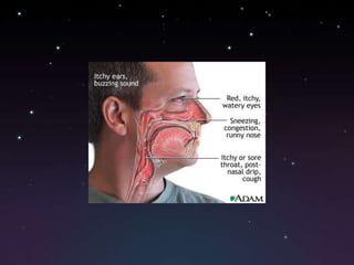 Rhinitis report | PPTX | Ear, Nose and Throat Conditions | Diseases and ...