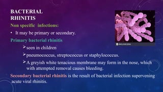 acute and chronic rhinitis by dr supriya | PPTX
