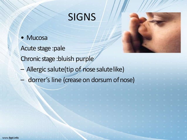 Rhinitis types | PPTX