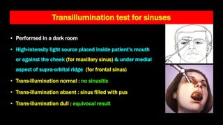 Rhinosinusitis- Definition, Clinical features, Diagnosis.pptx
