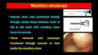Rhinosinusitis- Definition, Clinical features, Diagnosis.pptx