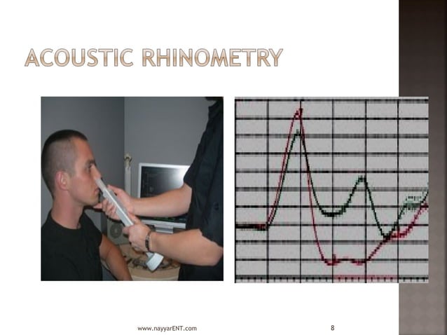 Rhinomanometry | PPT