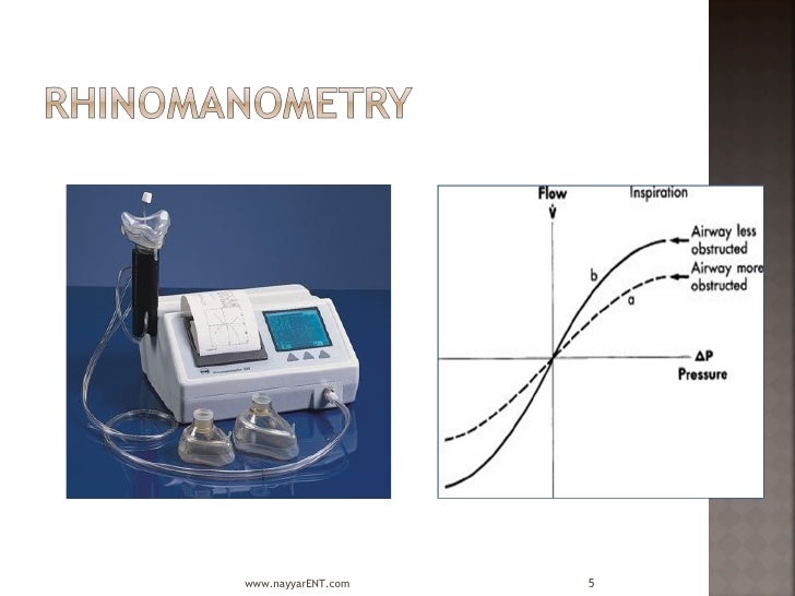Rhinomanometry
