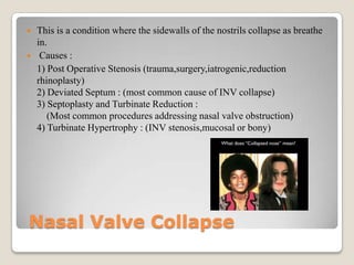 Rhinoplasty (Nose Anatomy) | PPTX